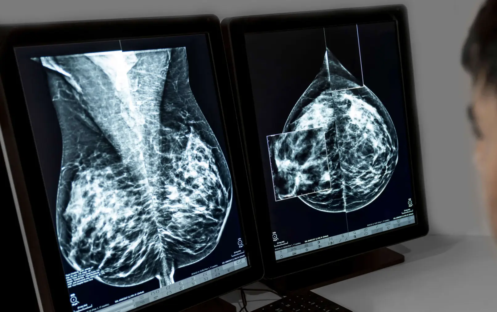Mammography Canadian Diagnostic Network