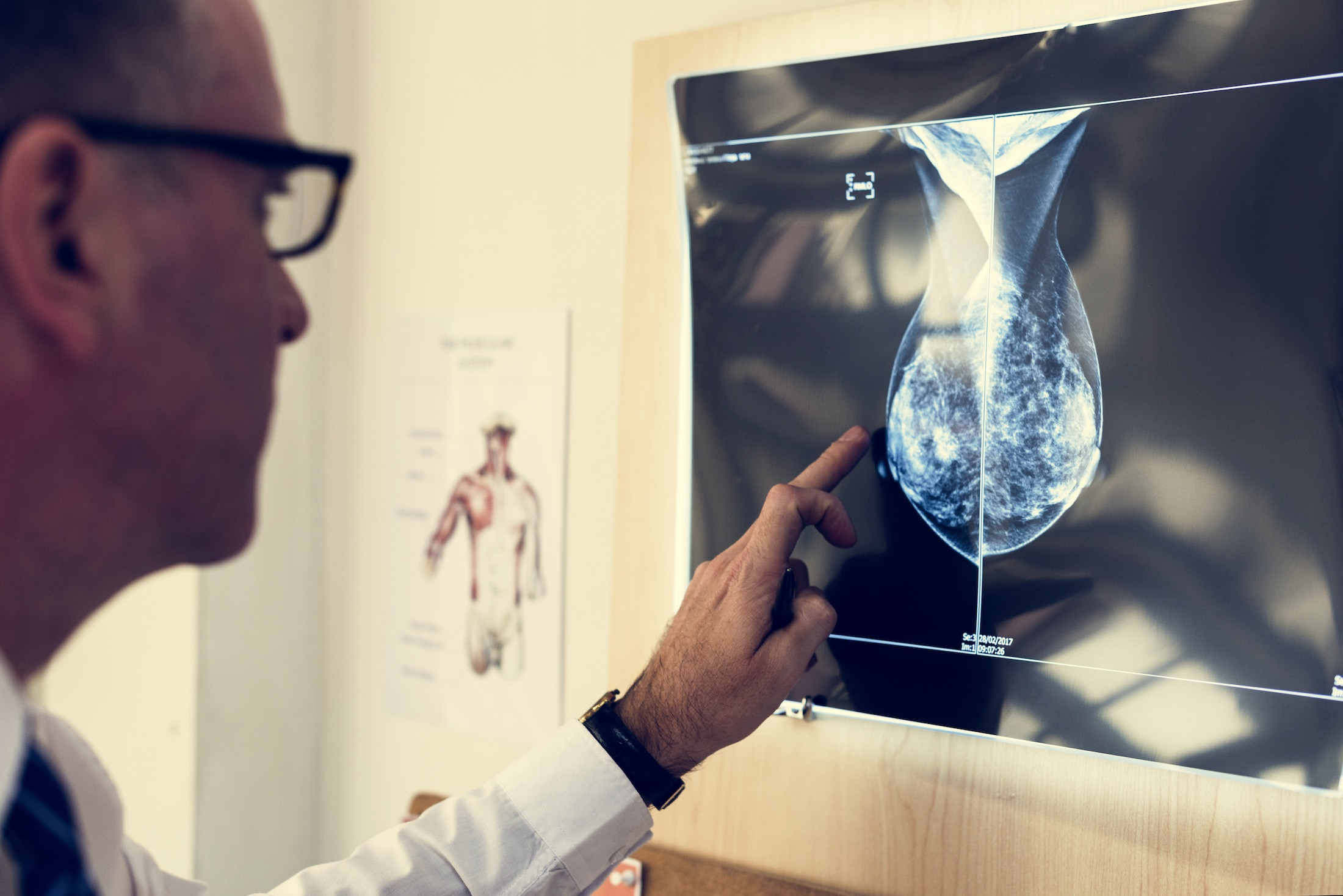 What to Do After an Abnormal Mammogram: Next Steps
